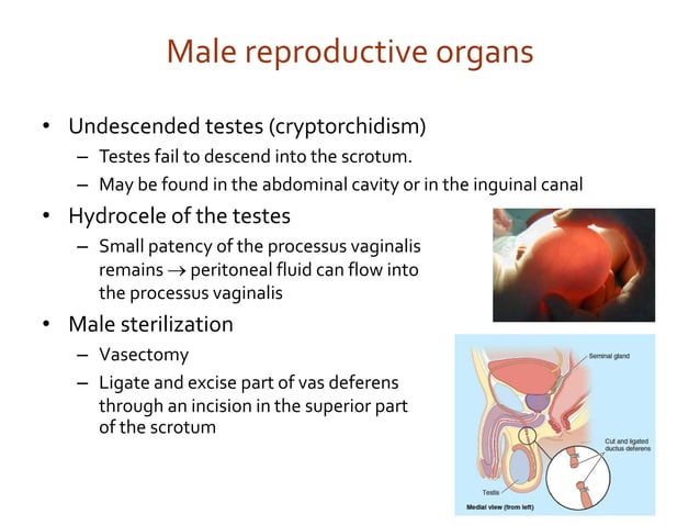 USMLE step 1 Review Anatomy of Reproductive System 2018 | PDF ...