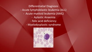 review Article on APML.ppsx