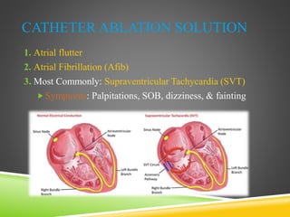 Septal Ablations Presentation | PPTX