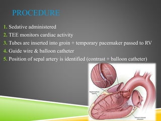 Septal Ablations Presentation | PPTX