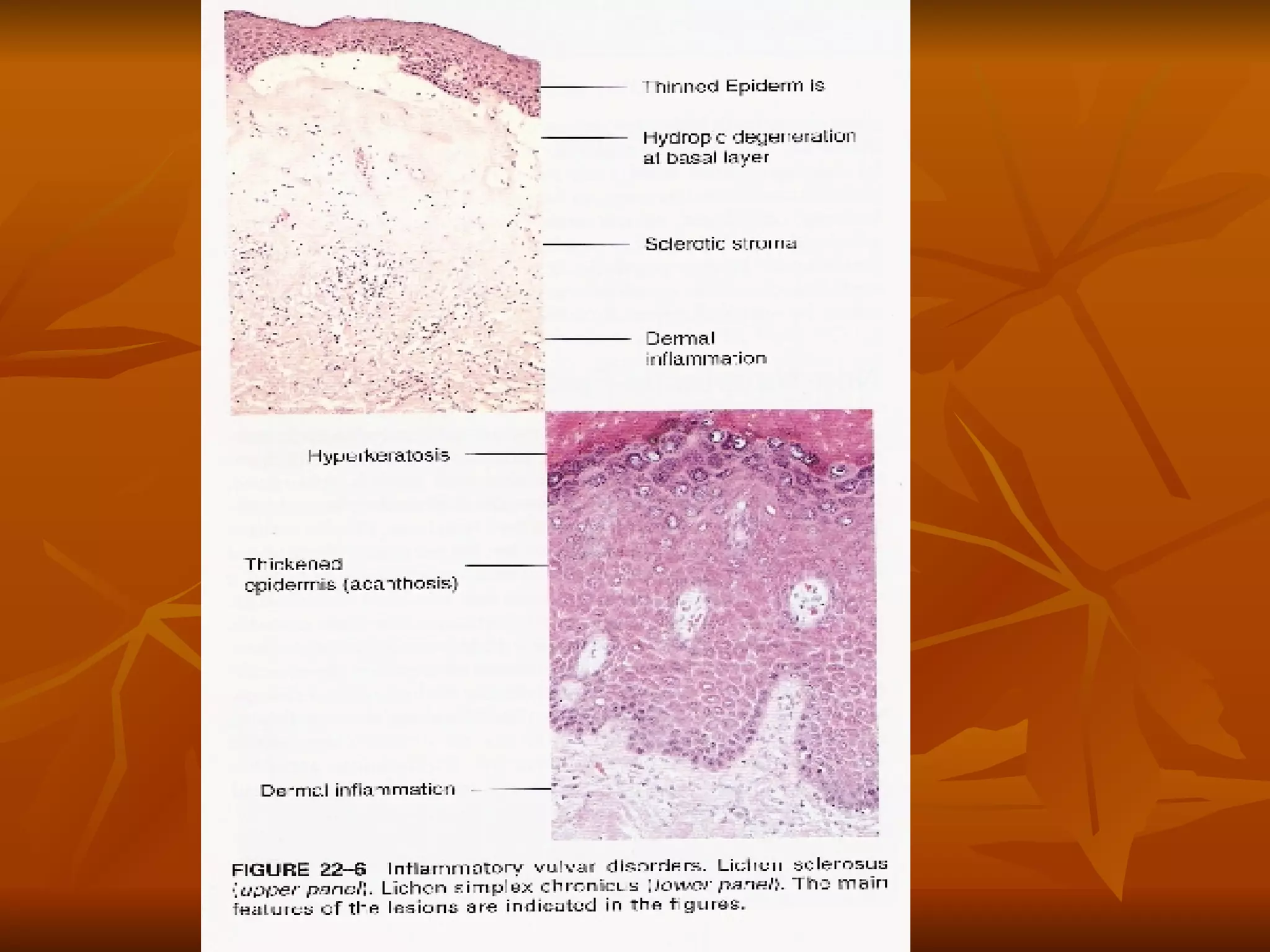 Female Genital Tract Pathology | PPT