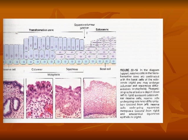 Female Genital Tract Pathology | PPT | Reproductive Health | Diseases ...