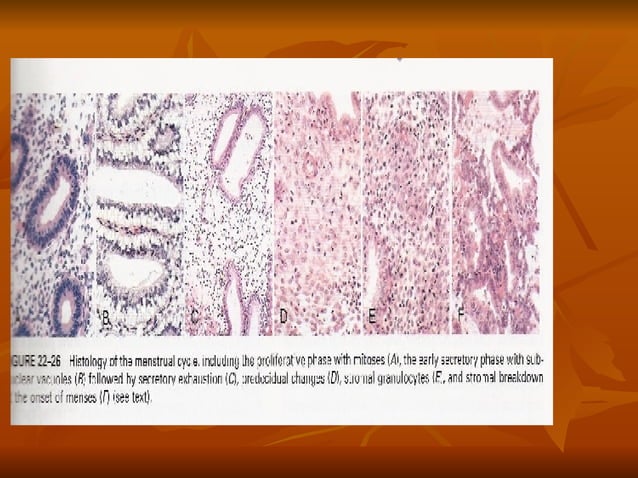 Female Genital Tract Pathology | PPT | Reproductive Health | Diseases ...