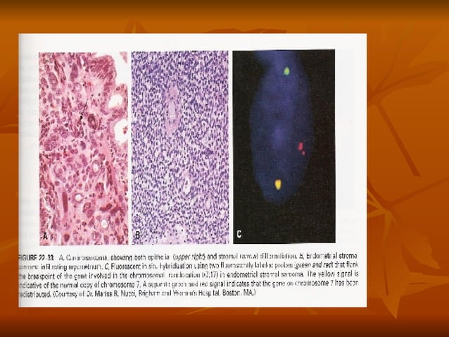 Female Genital Tract Pathology | PPT | Reproductive Health | Diseases ...