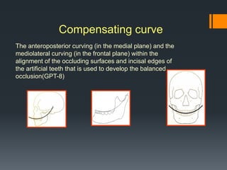 Review Occlusion -Refresher.pdf