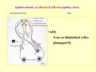 Review of neuro lecture | PPT