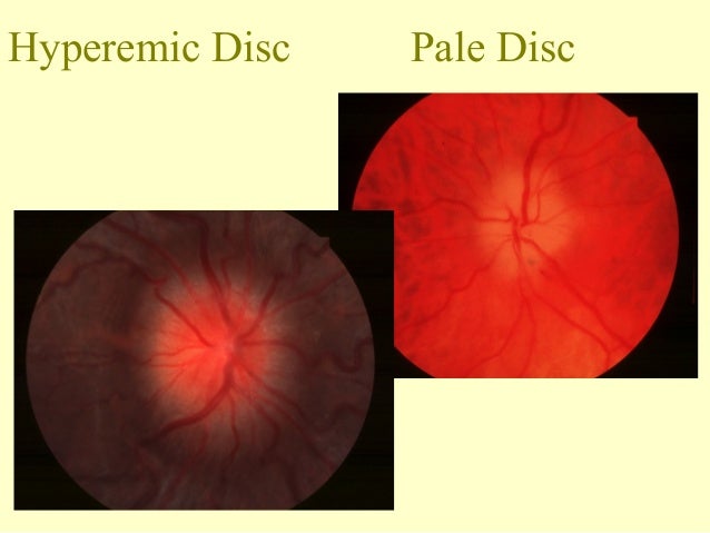 Review of neuro lecture