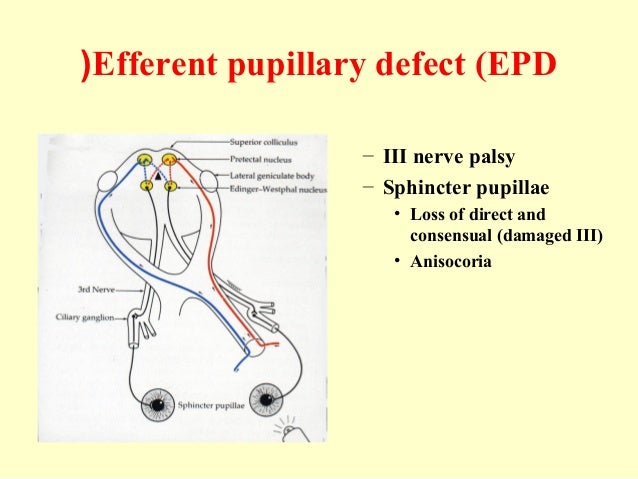Afferent Pupillary Pathway