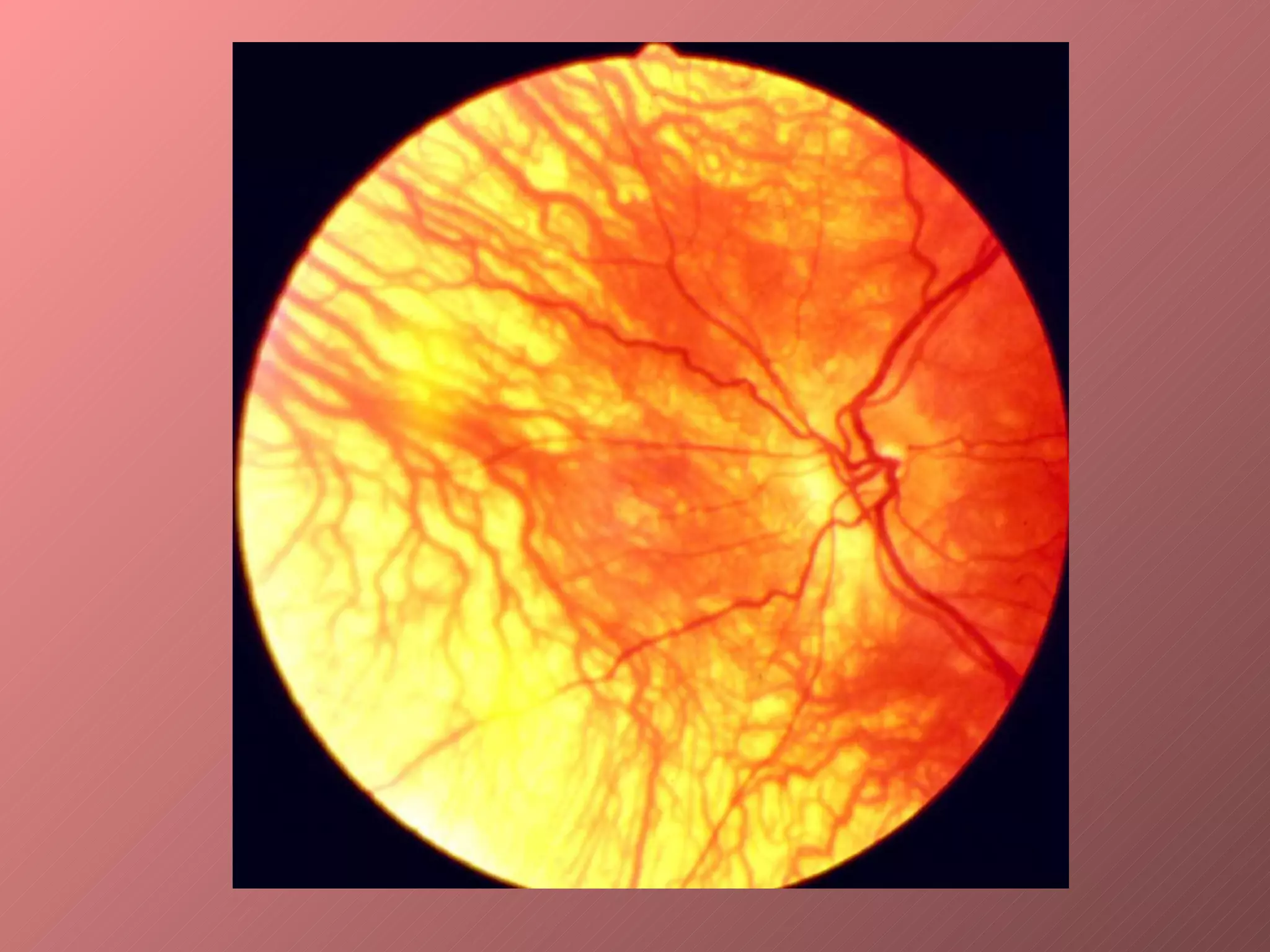 Review of pathology slides | PPT