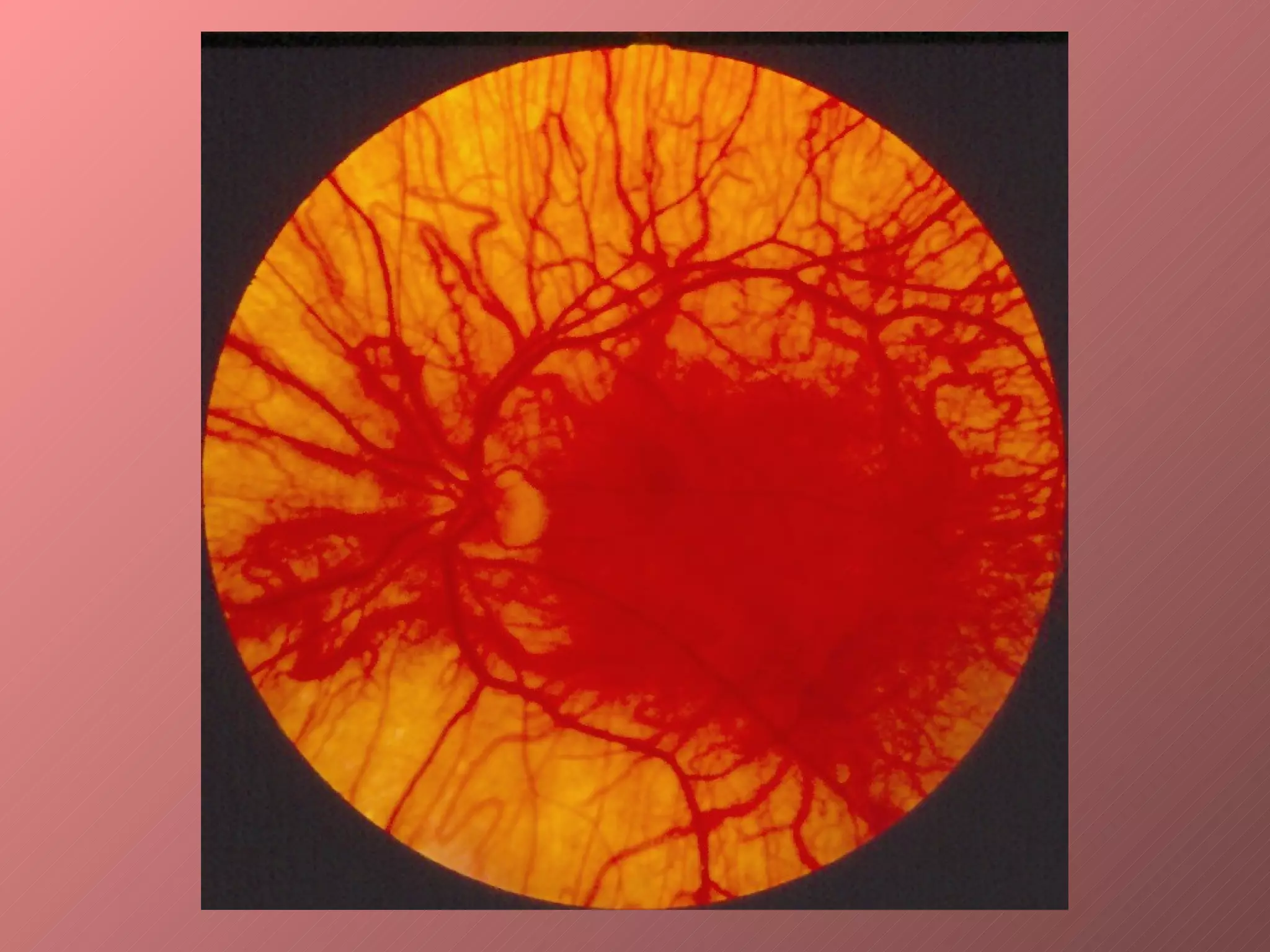 Review of pathology slides | PPT