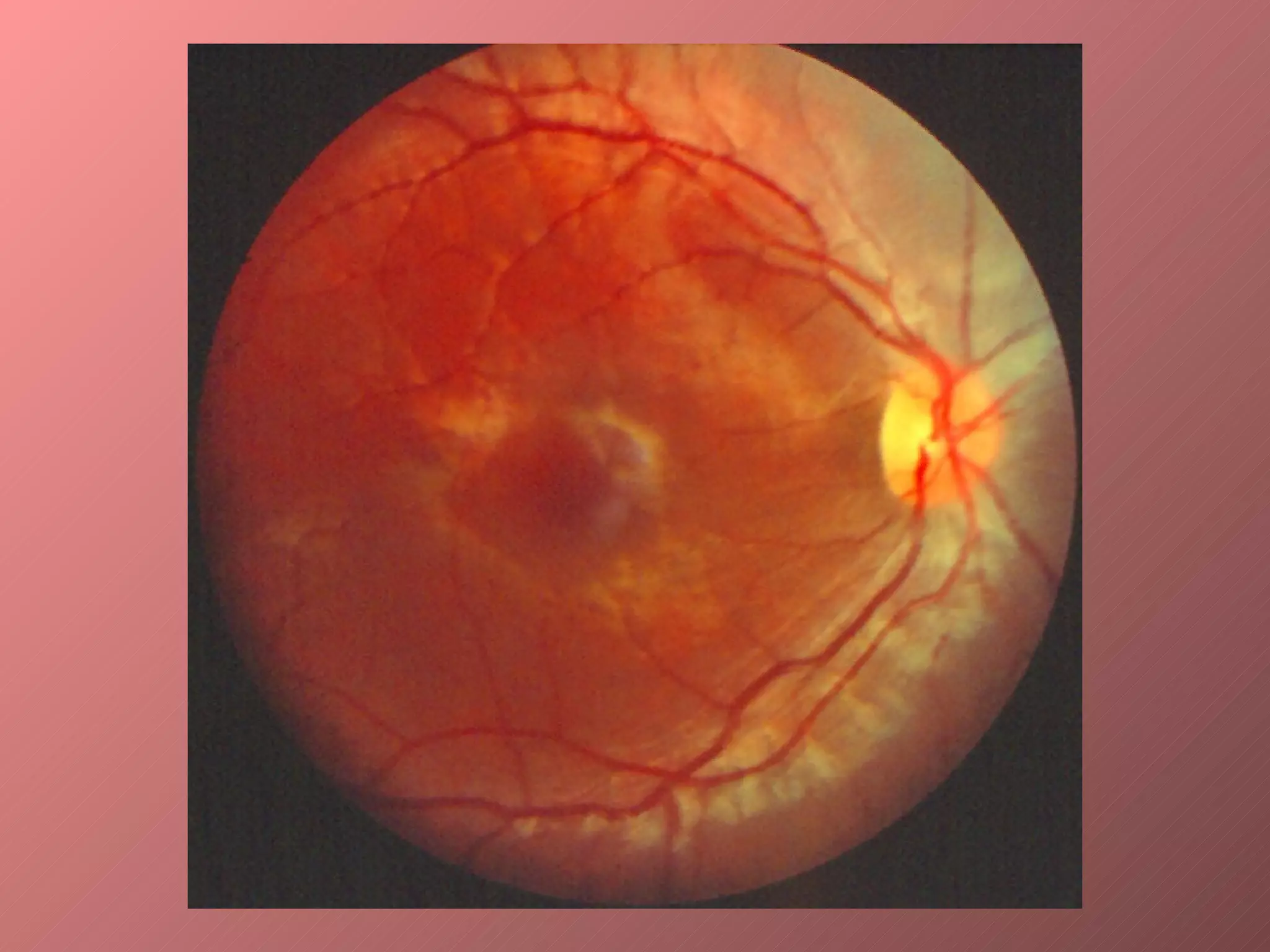 Review of pathology slides | PPT