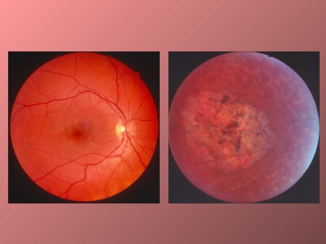 Review of pathology slides | PPT