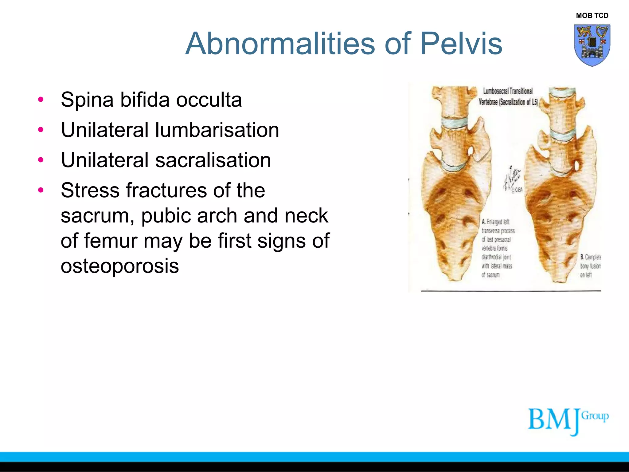 Review_of_Pelvic_Anatomy_BMJ.pptx