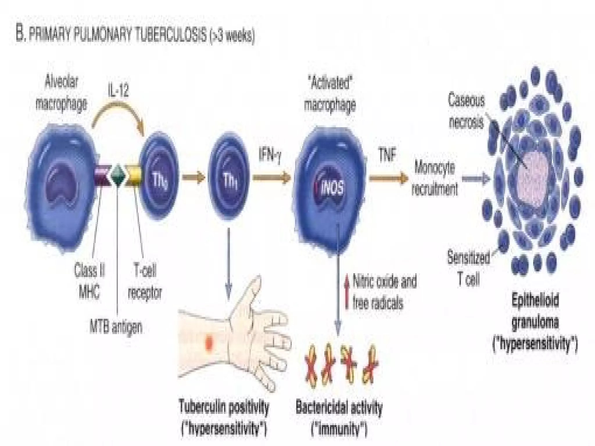 Review on microbiology and pathophysiology of tuberculosis | PPT