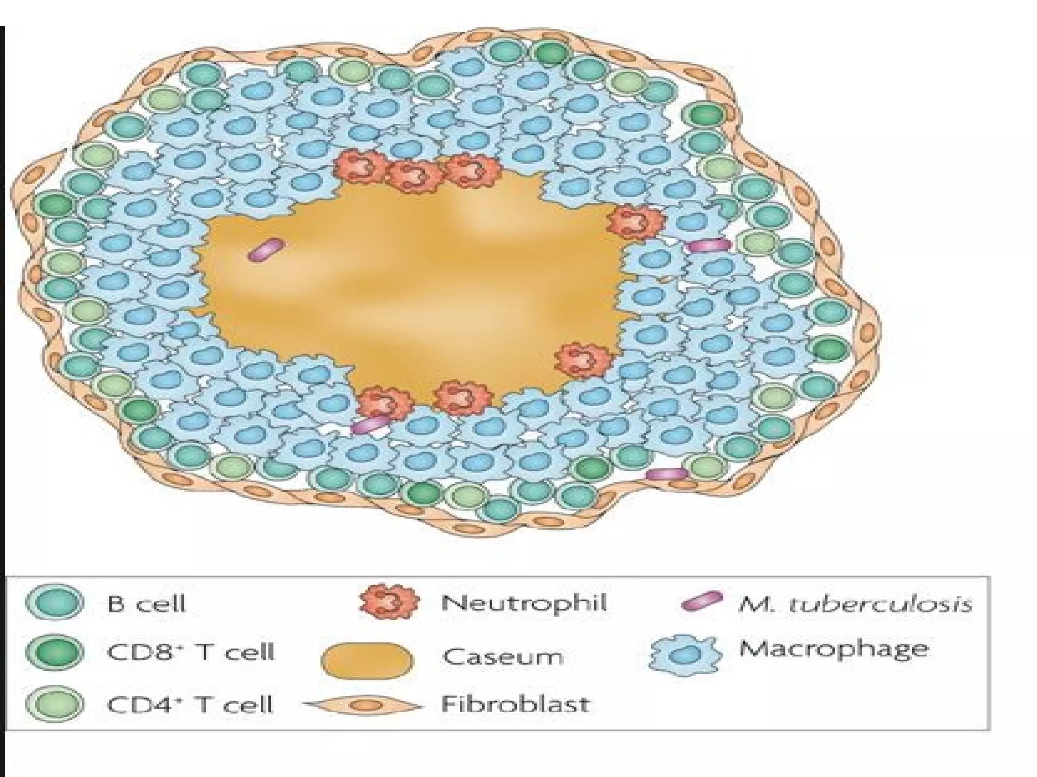 Review on microbiology and pathophysiology of tuberculosis | PPT