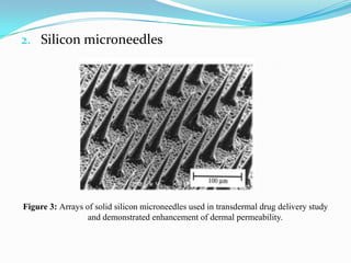 Review on microneedles | PPTX