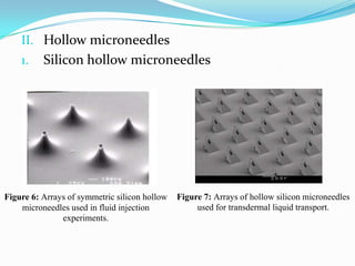 Review on microneedles | PPTX