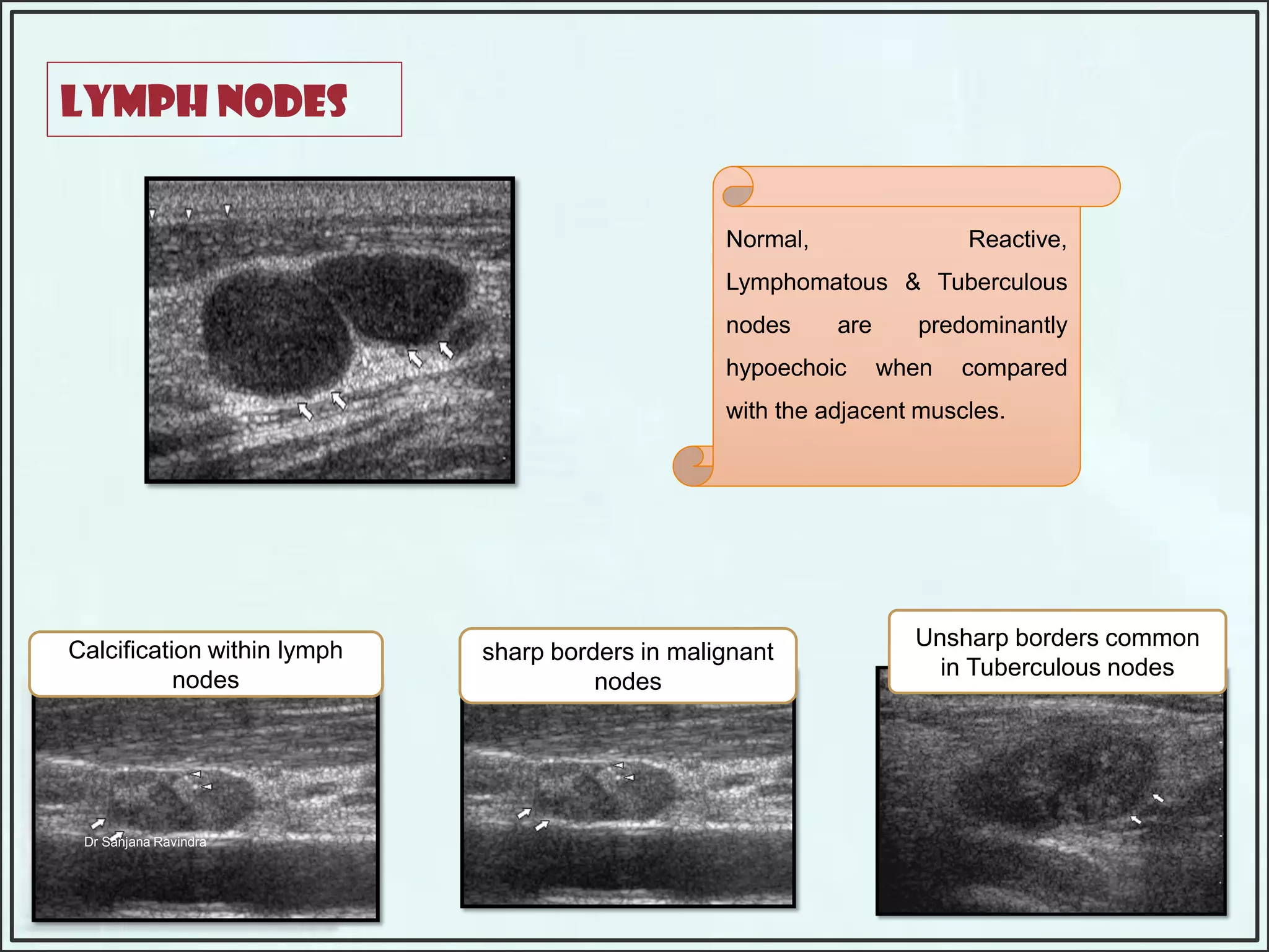 Review on the applications of ultrasonography in dentistry - Dr Sanjana ...