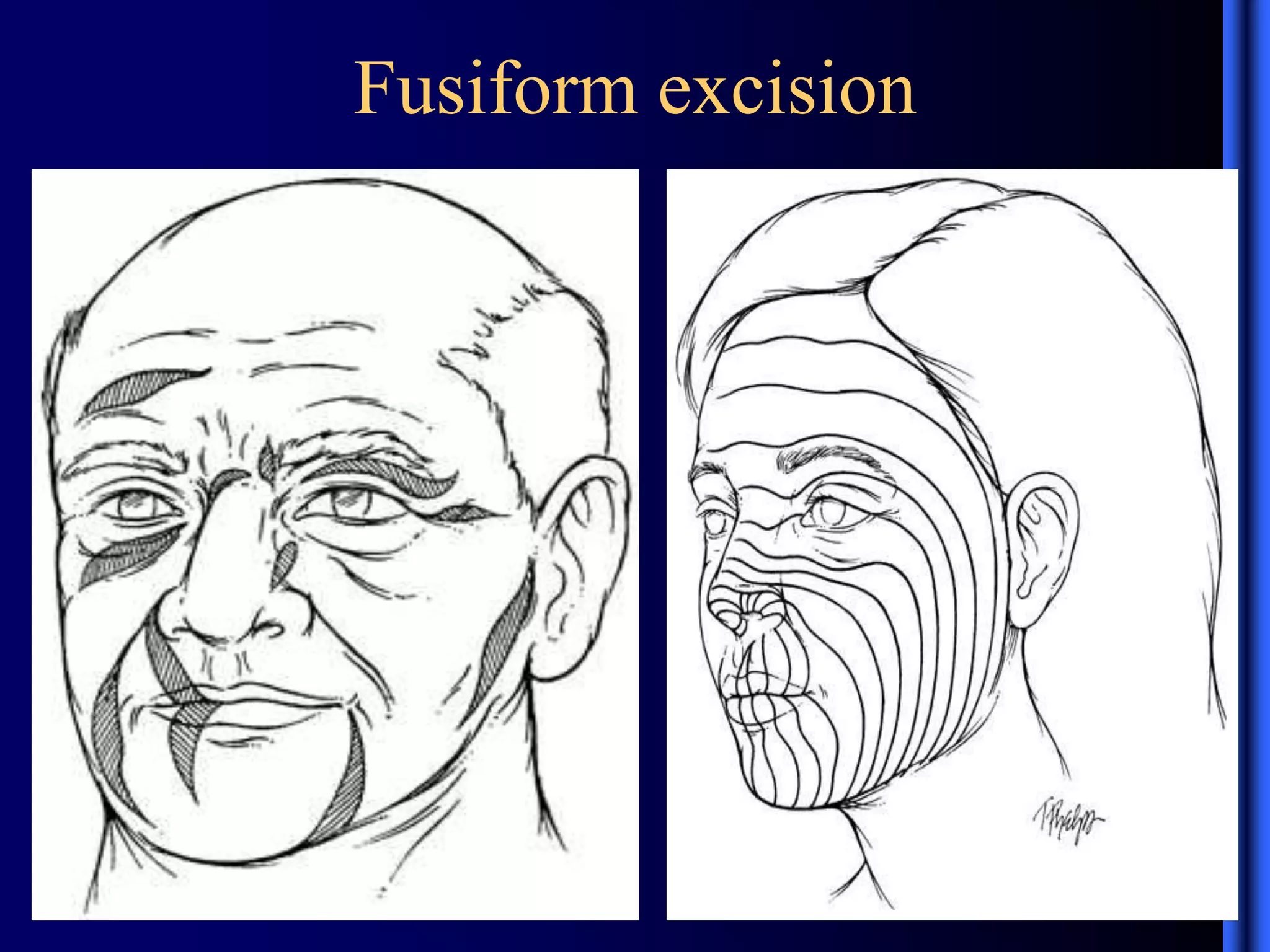 Revisão de Cicatriz.pptx