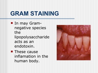 Revised Gram Staining | PPT