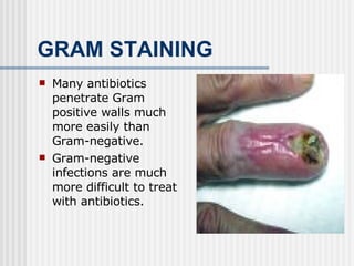 Revised Gram Staining | PPT