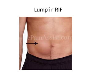 Abdominal lump it's evaluation and management.pptx