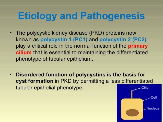 Autosomal Dominant Polycystic Kidney Disease