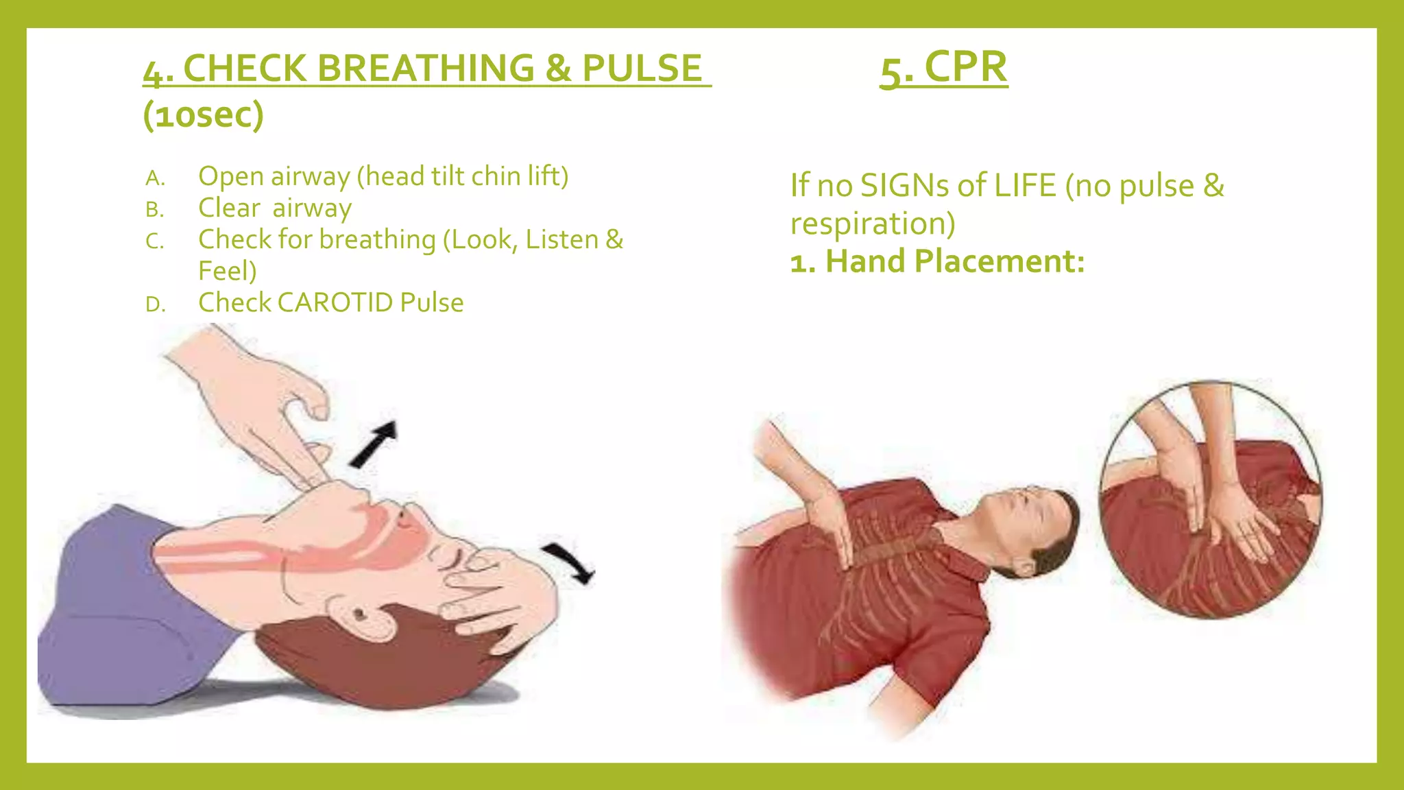REVISED BLS PPT.pptx | Free Download