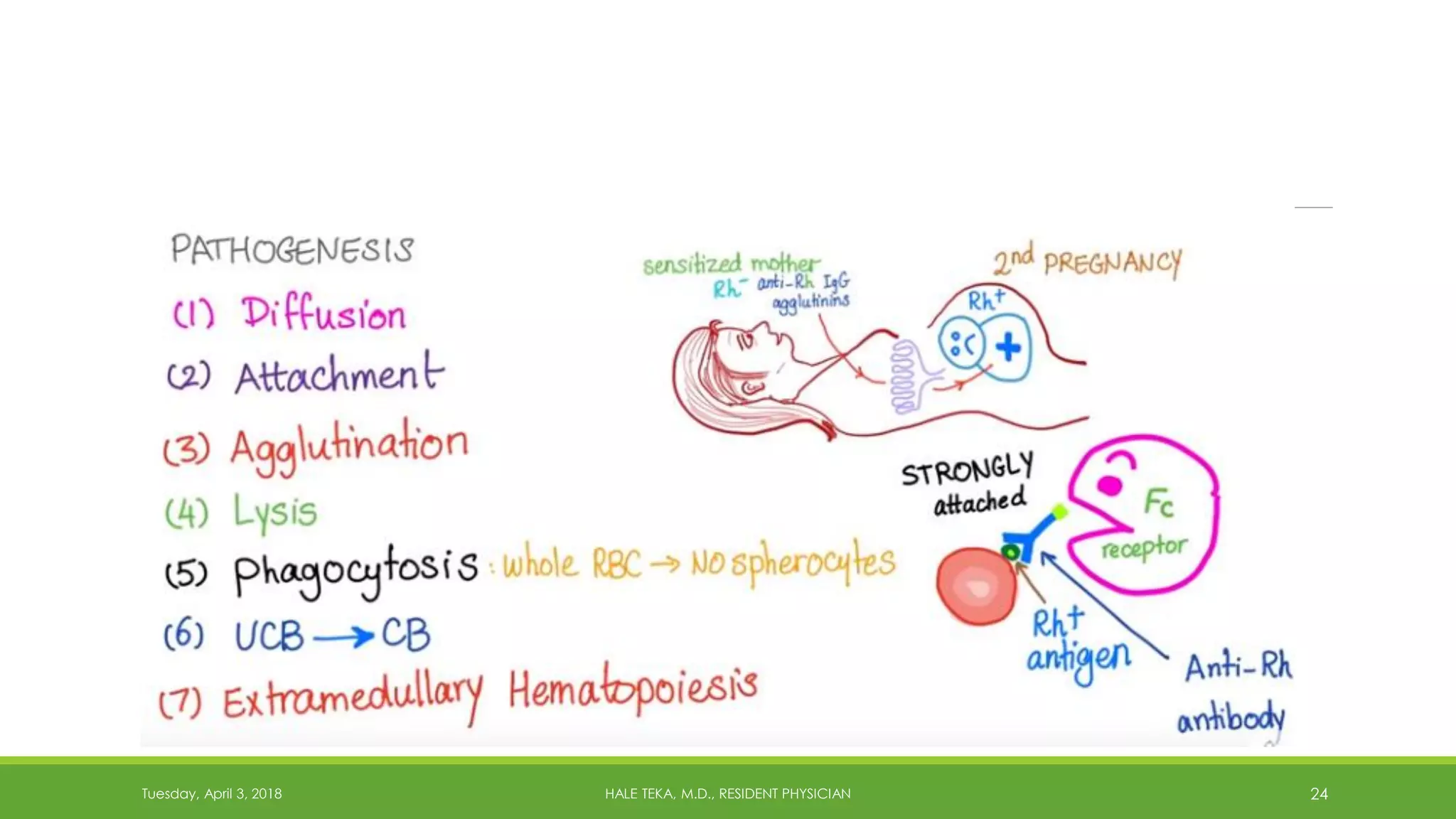 Revised fetal hydrops (immune and nonimmune) | PPT
