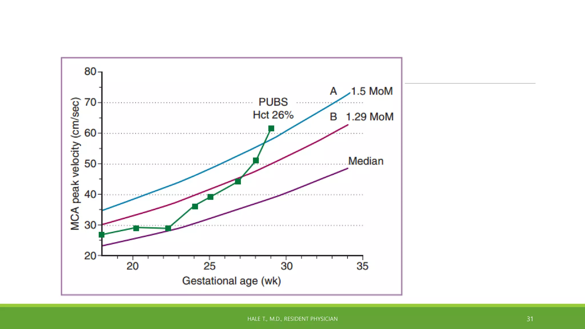 Revised fetal hydrops (immune and nonimmune) | PPT