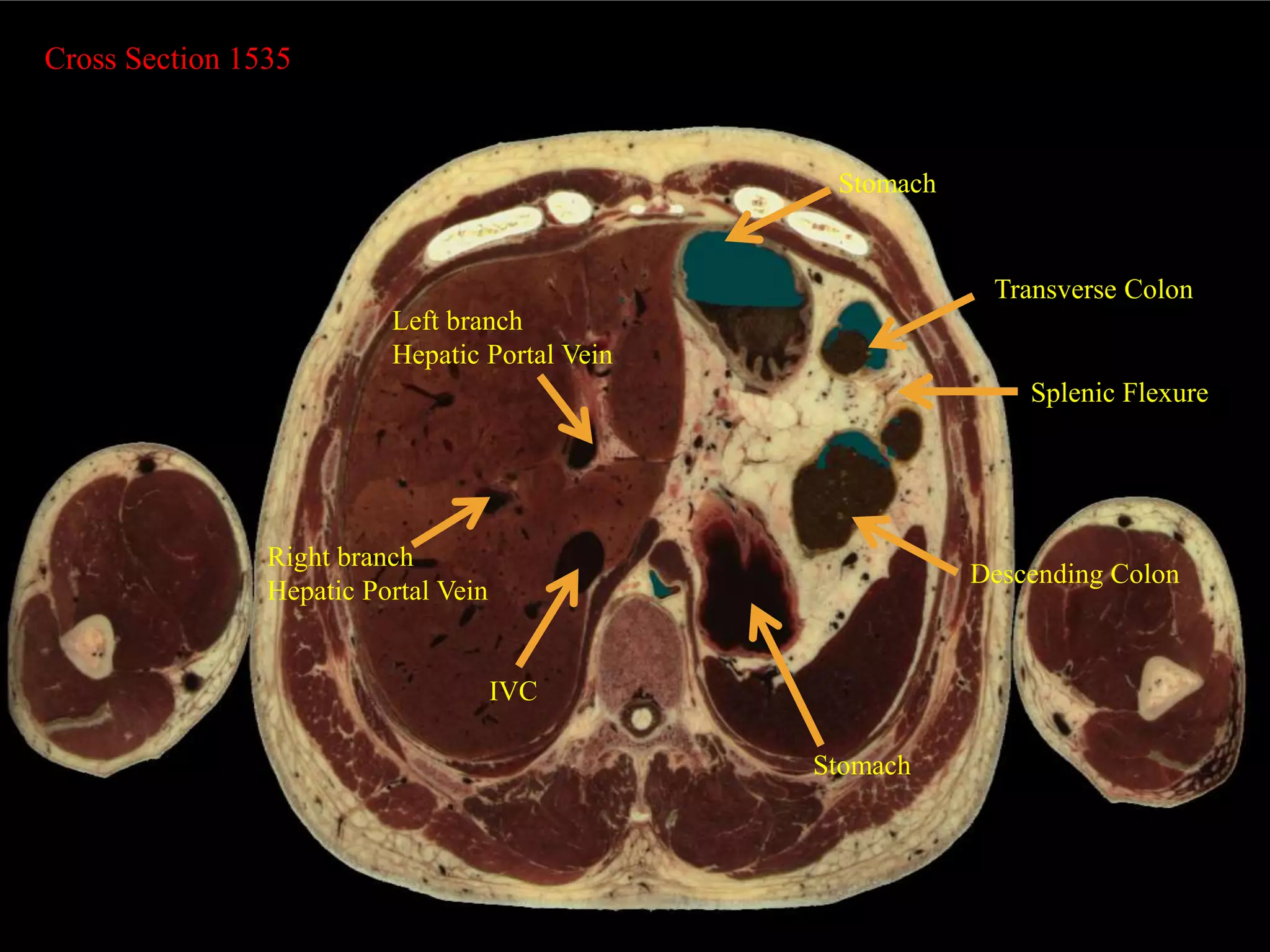 GI anatomy review | PPTX