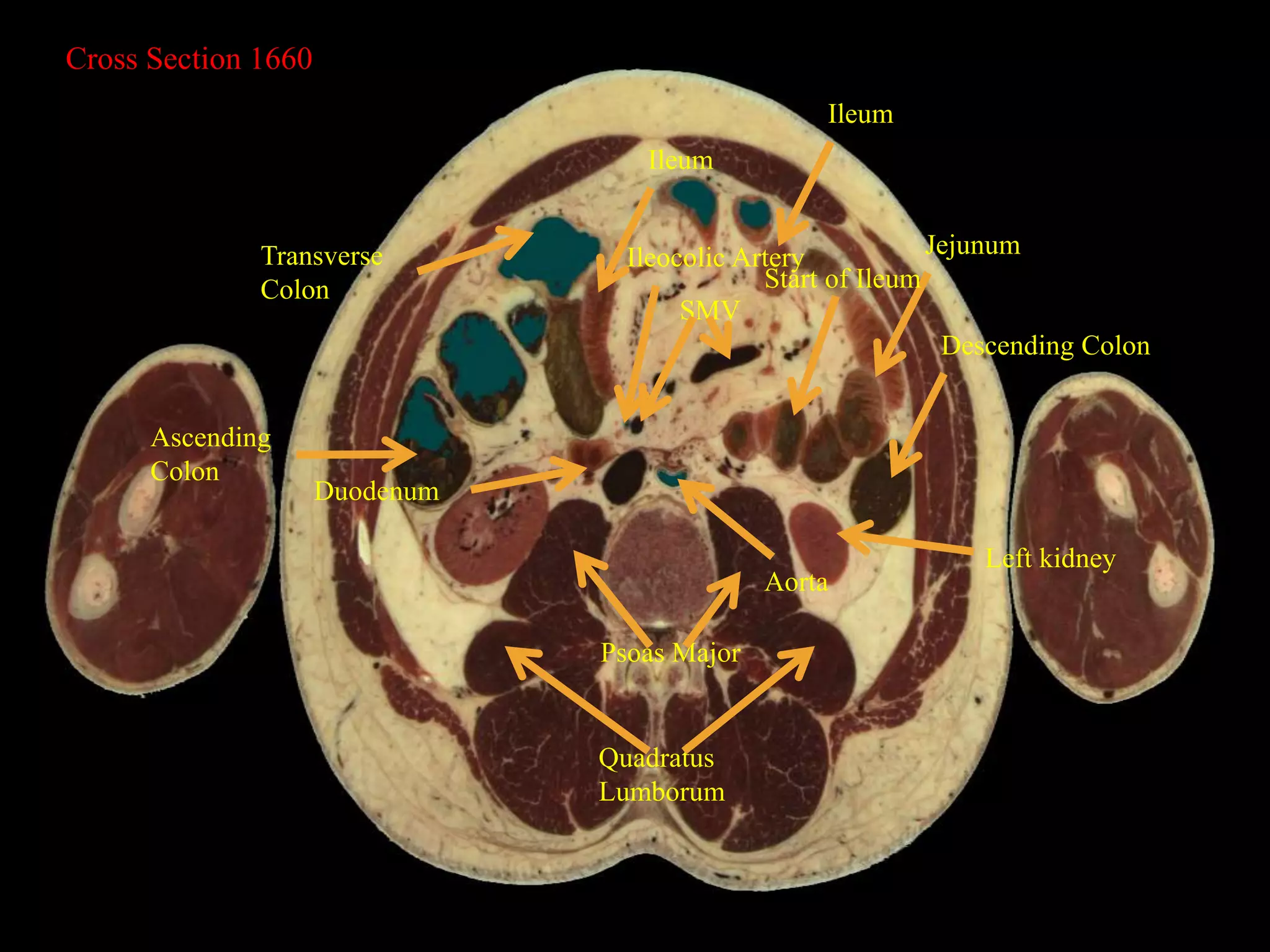GI anatomy review | PPTX