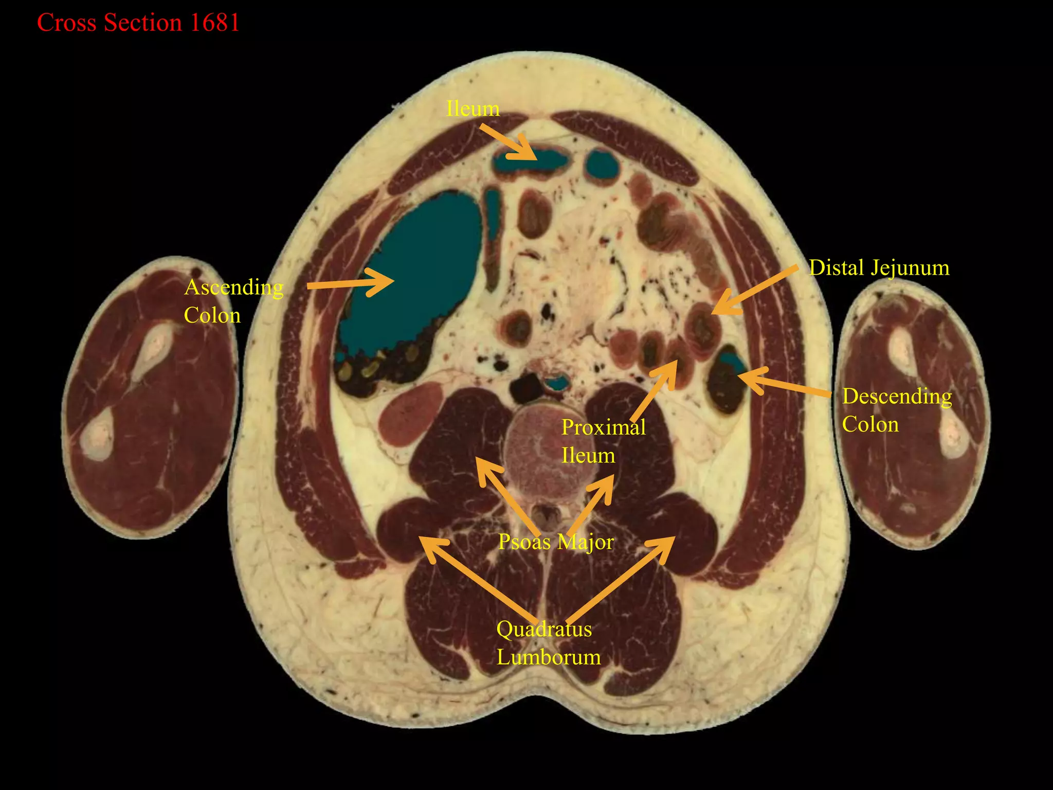 GI anatomy review | PPTX