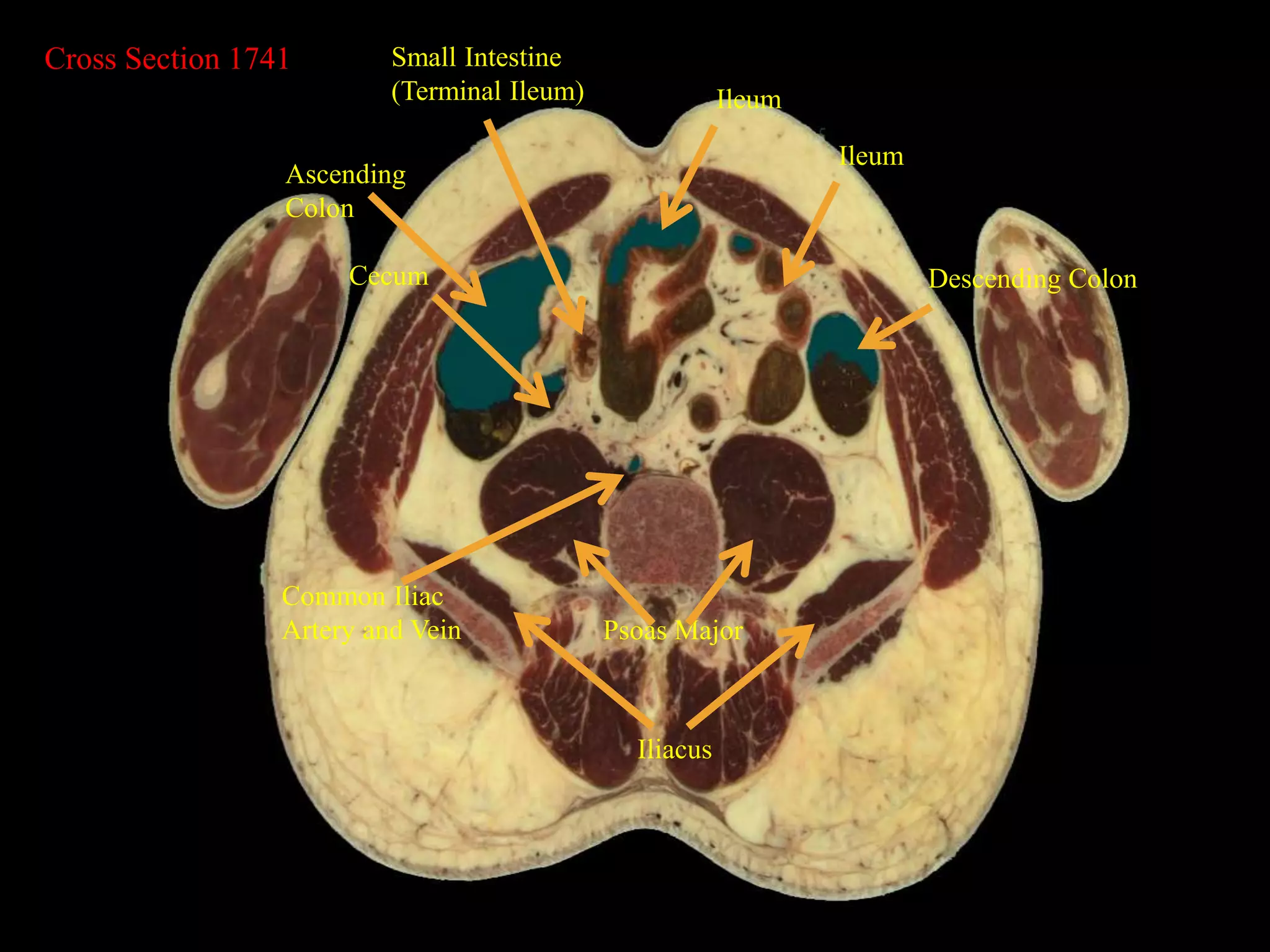 GI anatomy review | PPTX