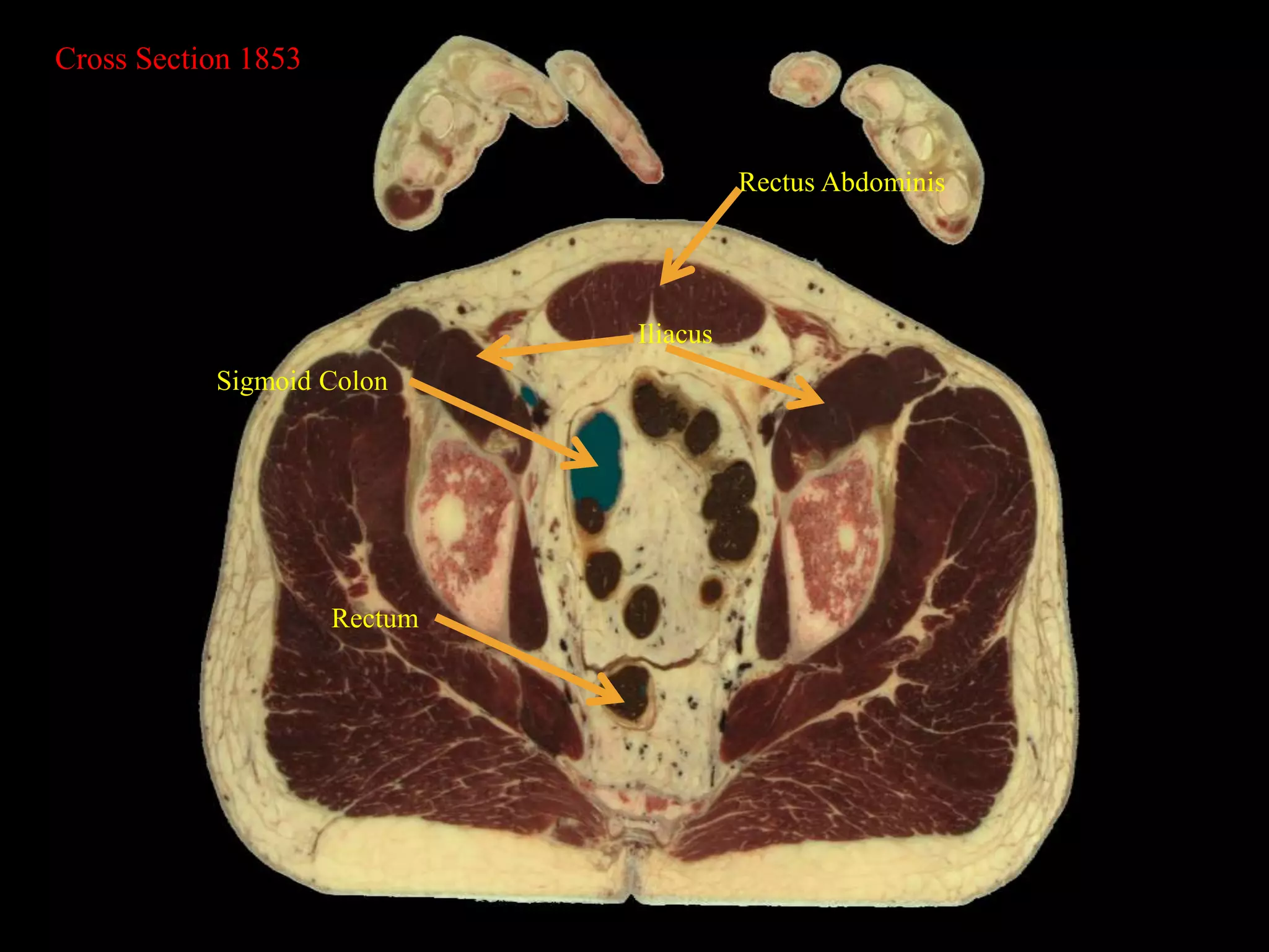 GI anatomy review | PPTX