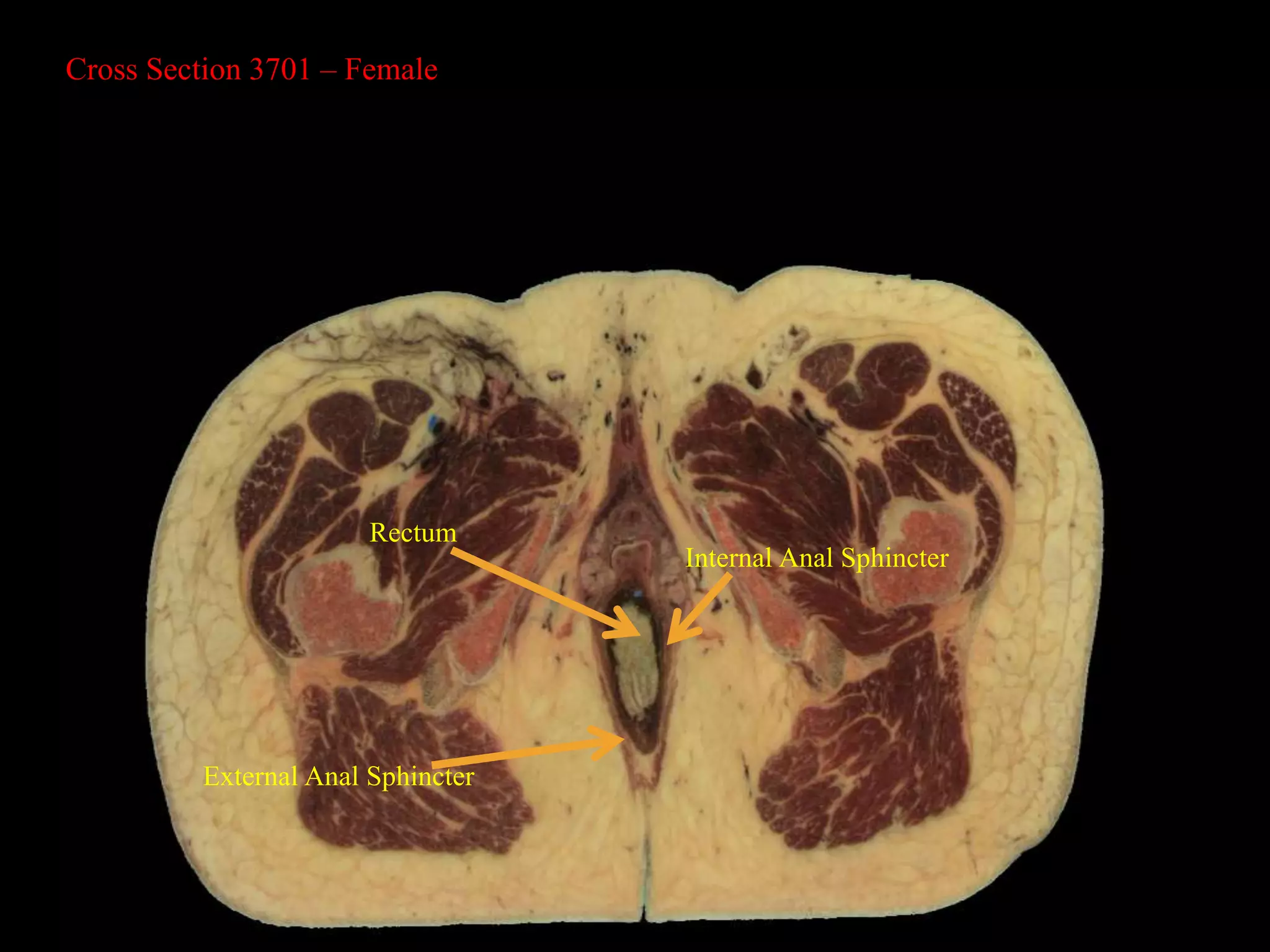 GI anatomy review | PPTX