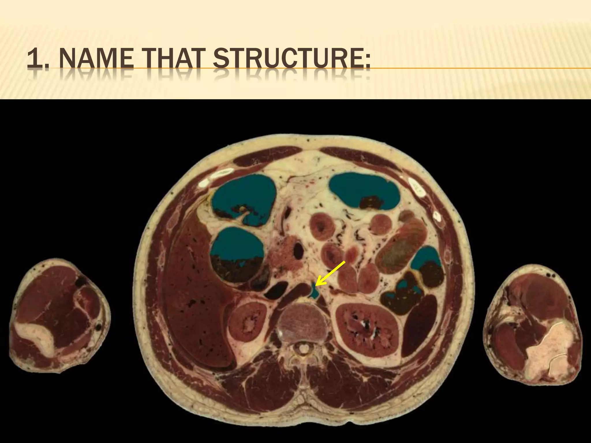 GI anatomy review | PPTX