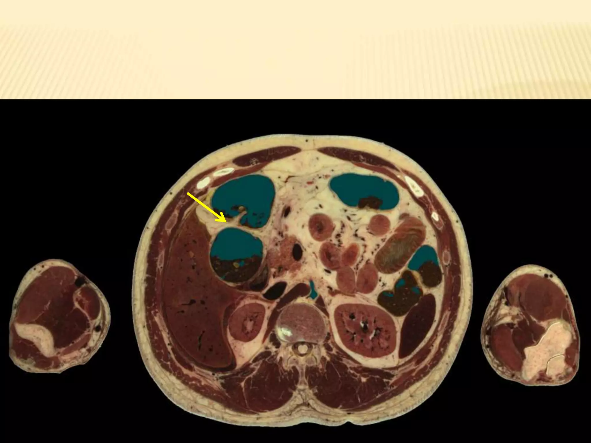 GI anatomy review | PPT