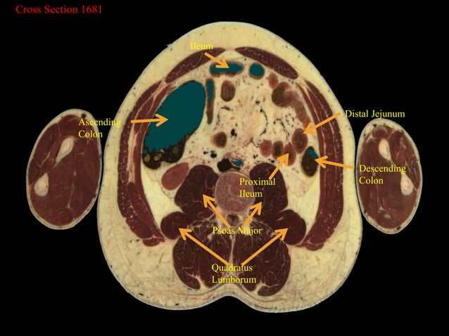 GI anatomy review | PPT