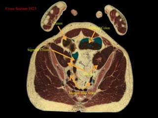 GI anatomy review | PPTX