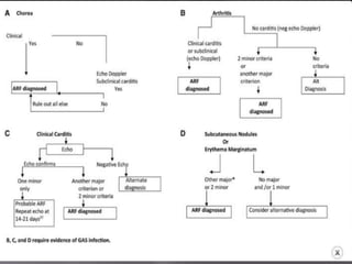 Revised jones criteria | PPTX