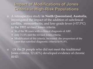 Revised jones criteria | PPTX