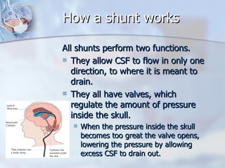 Hydrocephalus and Shunts: Sean's Story | PPT