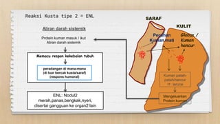 REVISI 2 REAKSI KUSTA | PPT