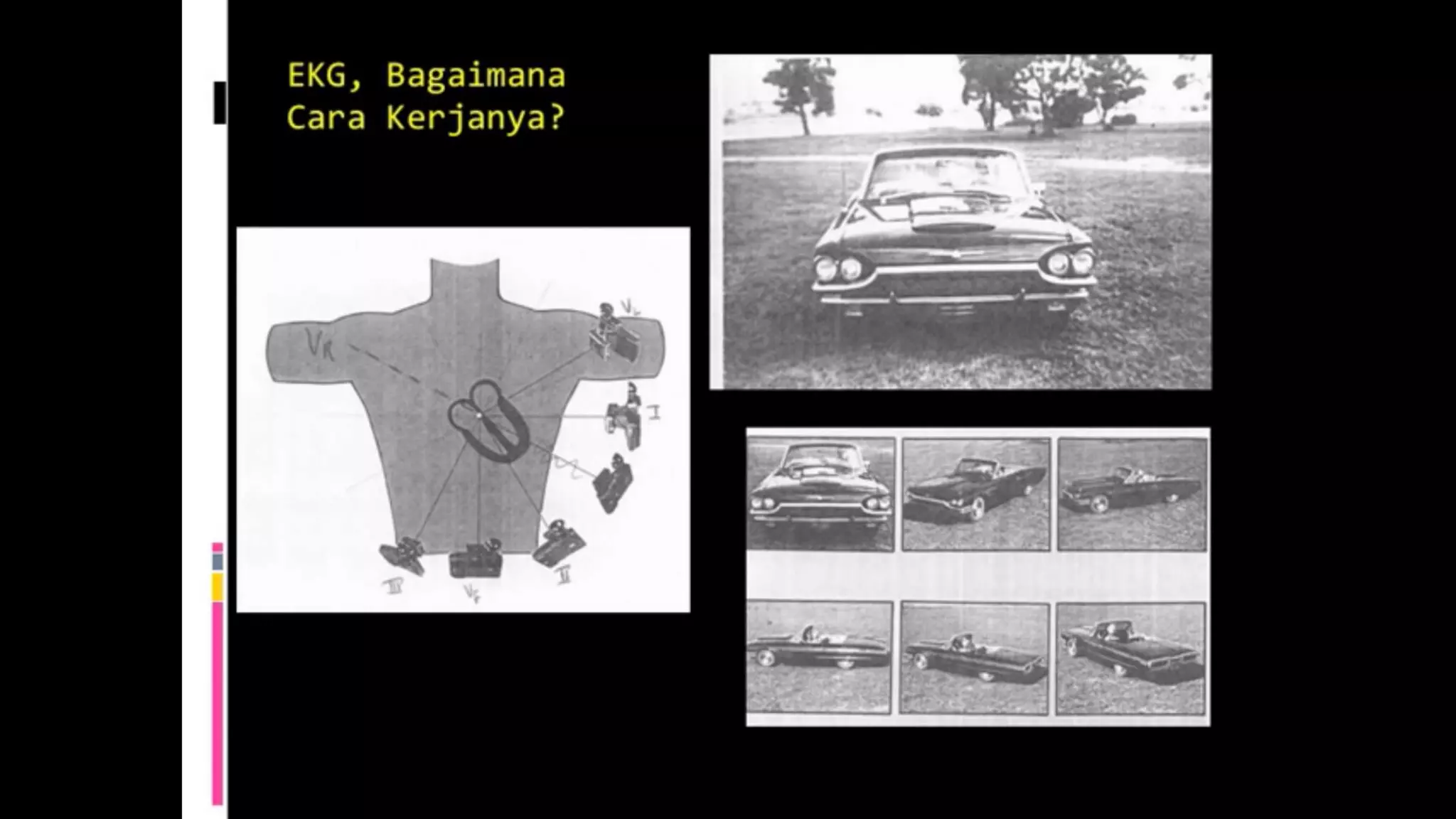 REVISI Materi 1 ECG Club - Dasar EKG, Sinus, Rate.pptx