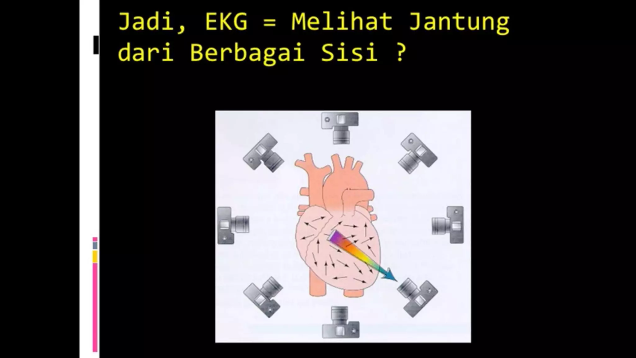 REVISI Materi 1 ECG Club - Dasar EKG, Sinus, Rate.pptx