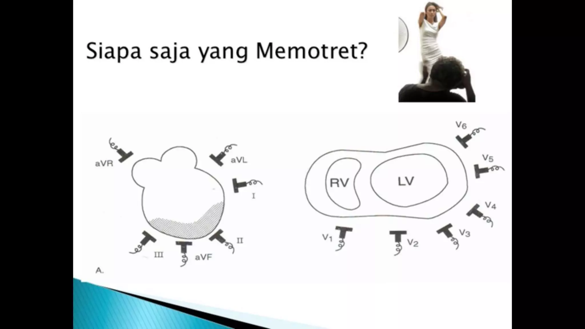 REVISI Materi 1 ECG Club - Dasar EKG, Sinus, Rate.pptx