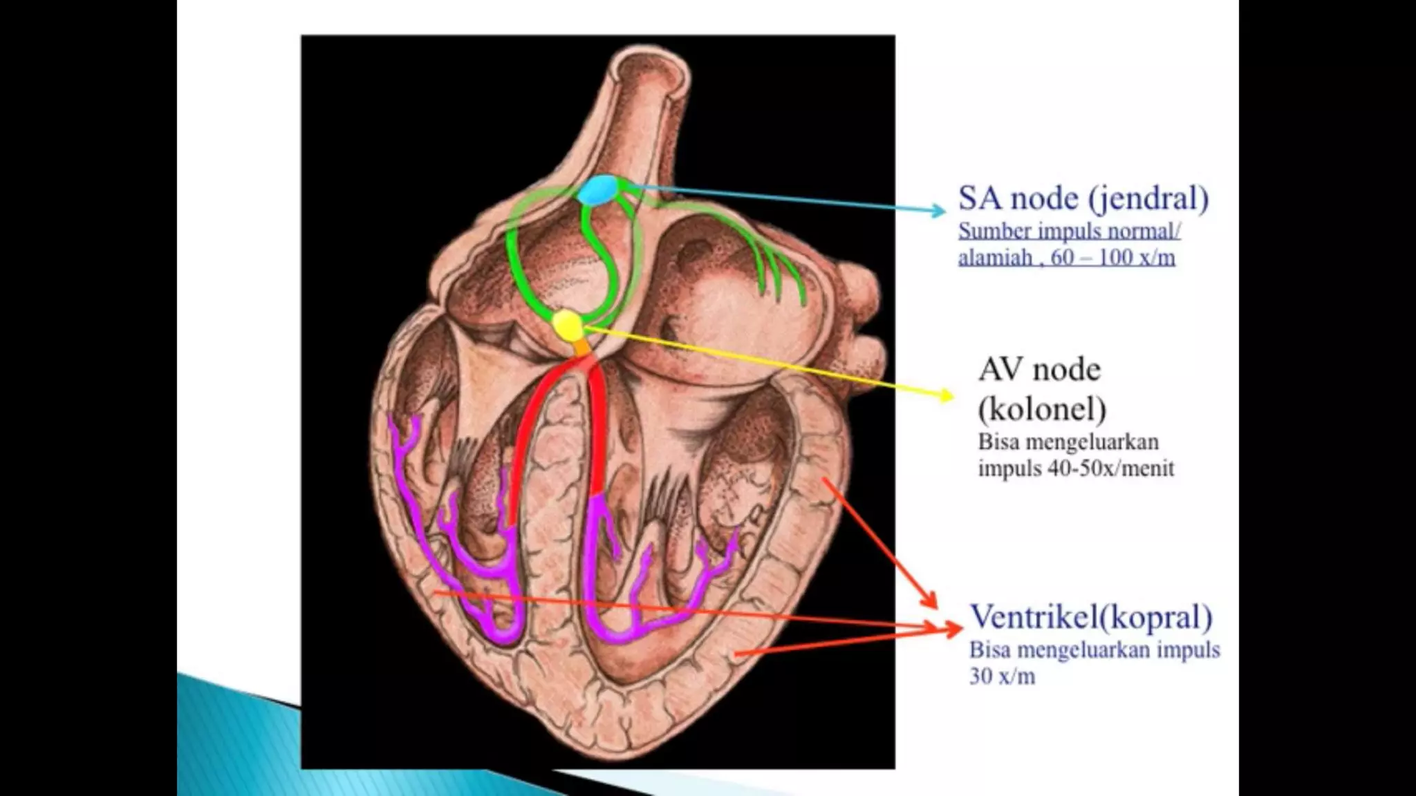 REVISI Materi 1 ECG Club - Dasar EKG, Sinus, Rate.pptx