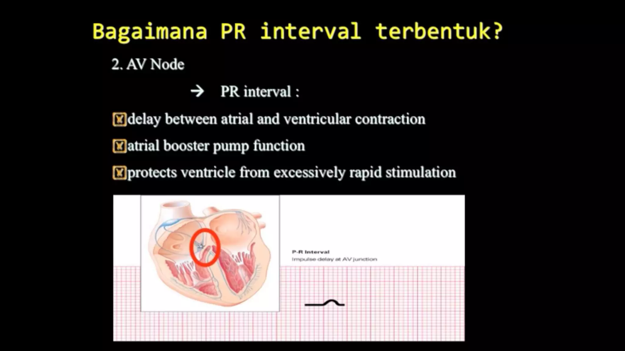 REVISI Materi 1 ECG Club - Dasar EKG, Sinus, Rate.pptx