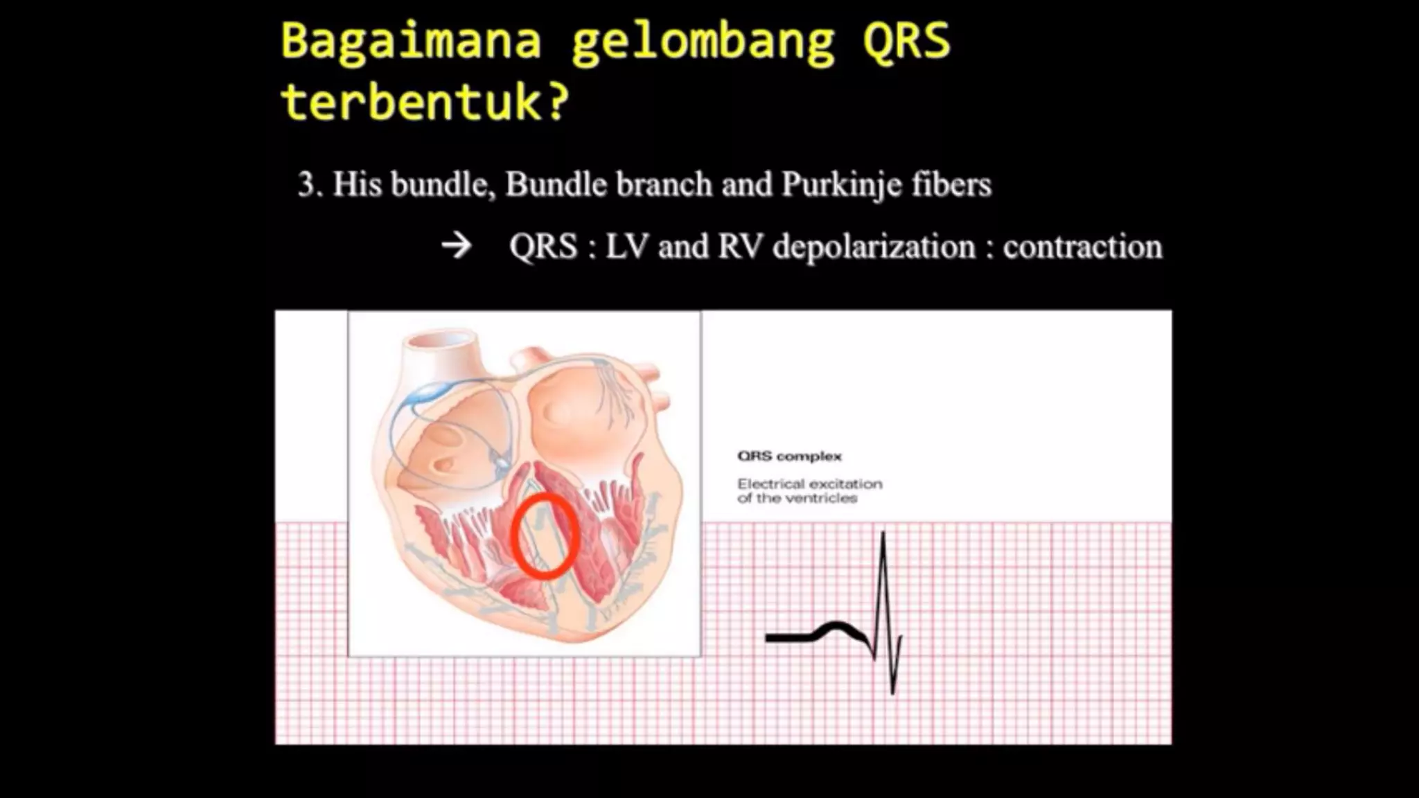 REVISI Materi 1 ECG Club - Dasar EKG, Sinus, Rate.pptx
